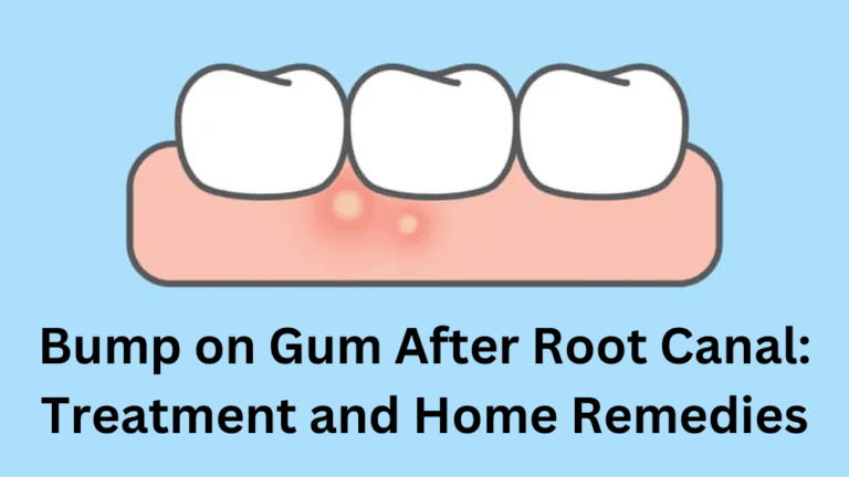 Bump on Gum After Root Canal: Treatment and Home Remedies - Healthy Rituals